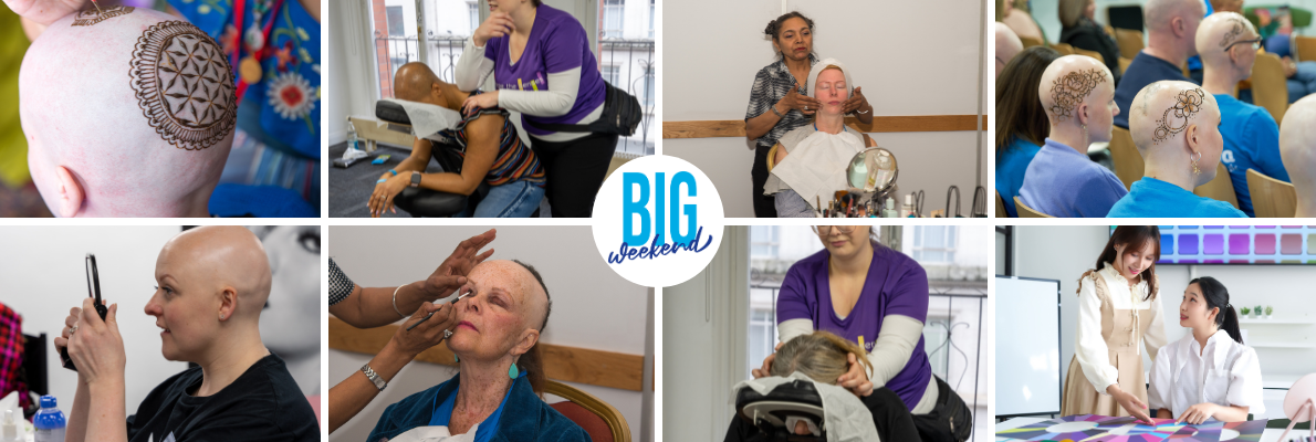 Alopecia UK Big Weekend - Wellbeing Hub | Birmingham [ Book now ]